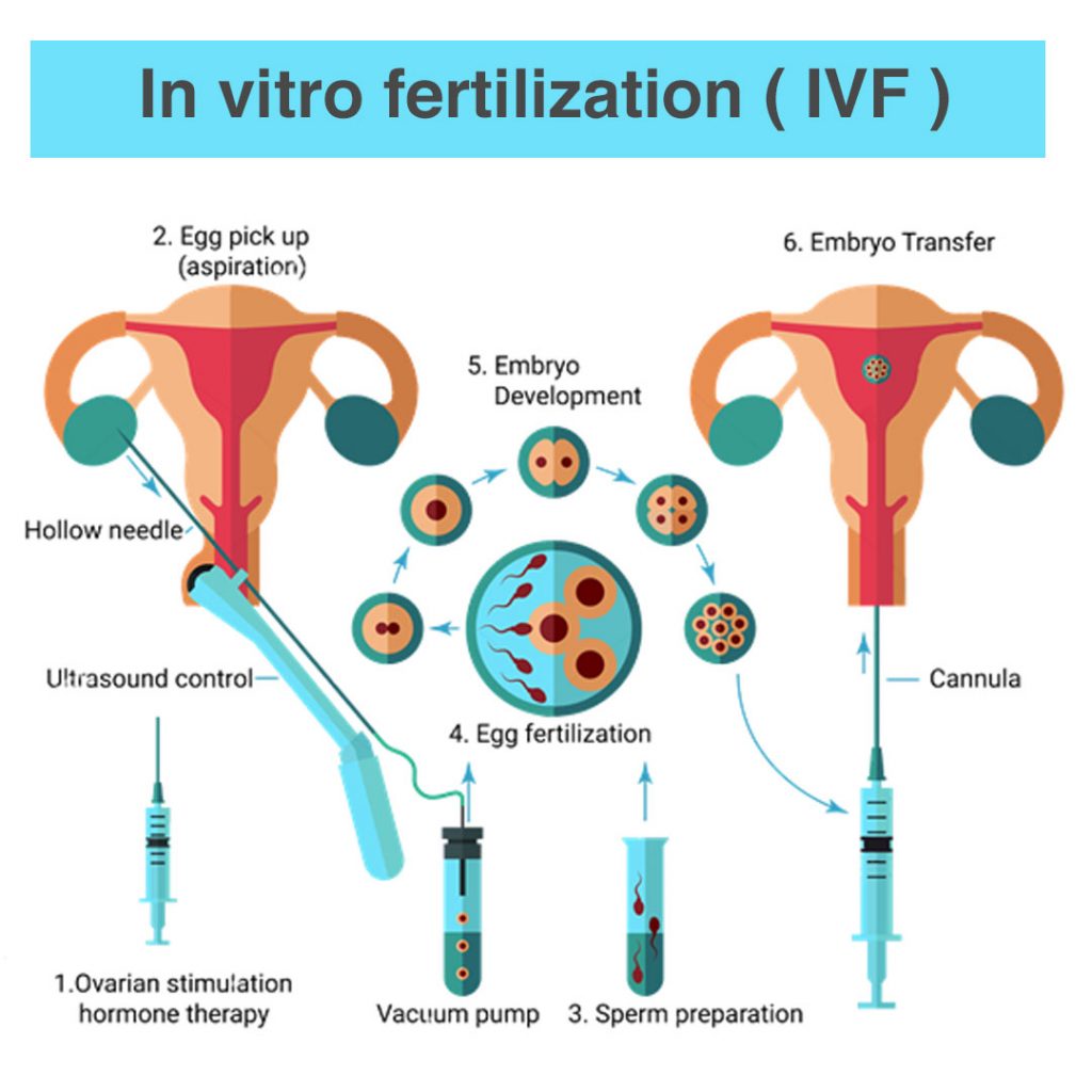 Difference between IVF and Test Tube Baby? | ChandigarhFirst.com