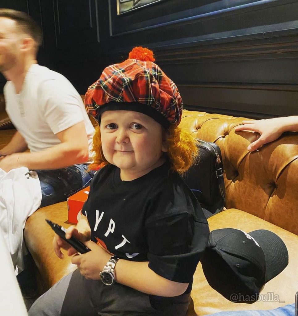 Who is Hasbulla? All you Must Know! | ChandigarhFirst.com